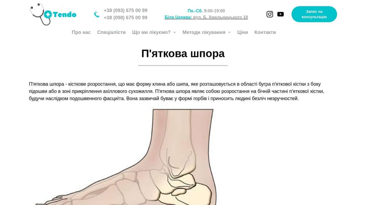 П'яткова шпора